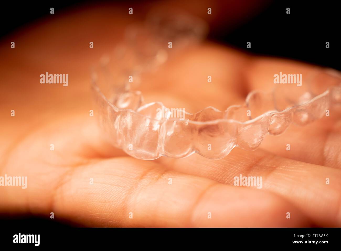 Invisible dental tooth bracket aligners to straighten teeth Stock Photo ...