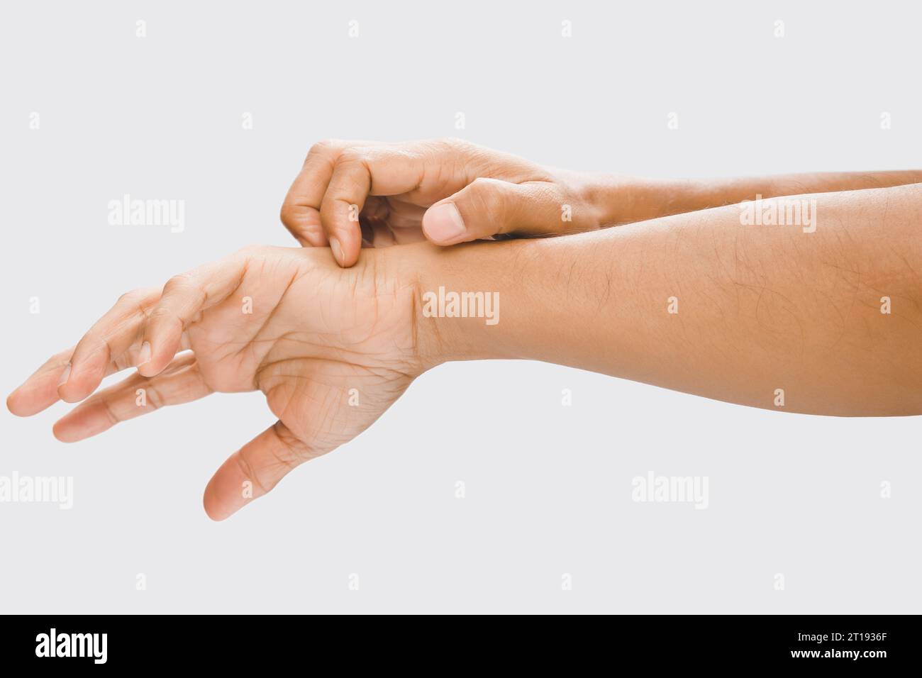 The man is scratching his back of hand because he has an itch due to an ...