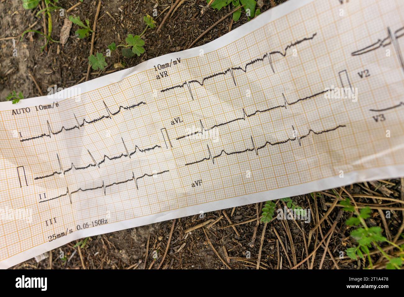 Abandoned ECG tracing on the ground, a poignant symbol of forgotten ...