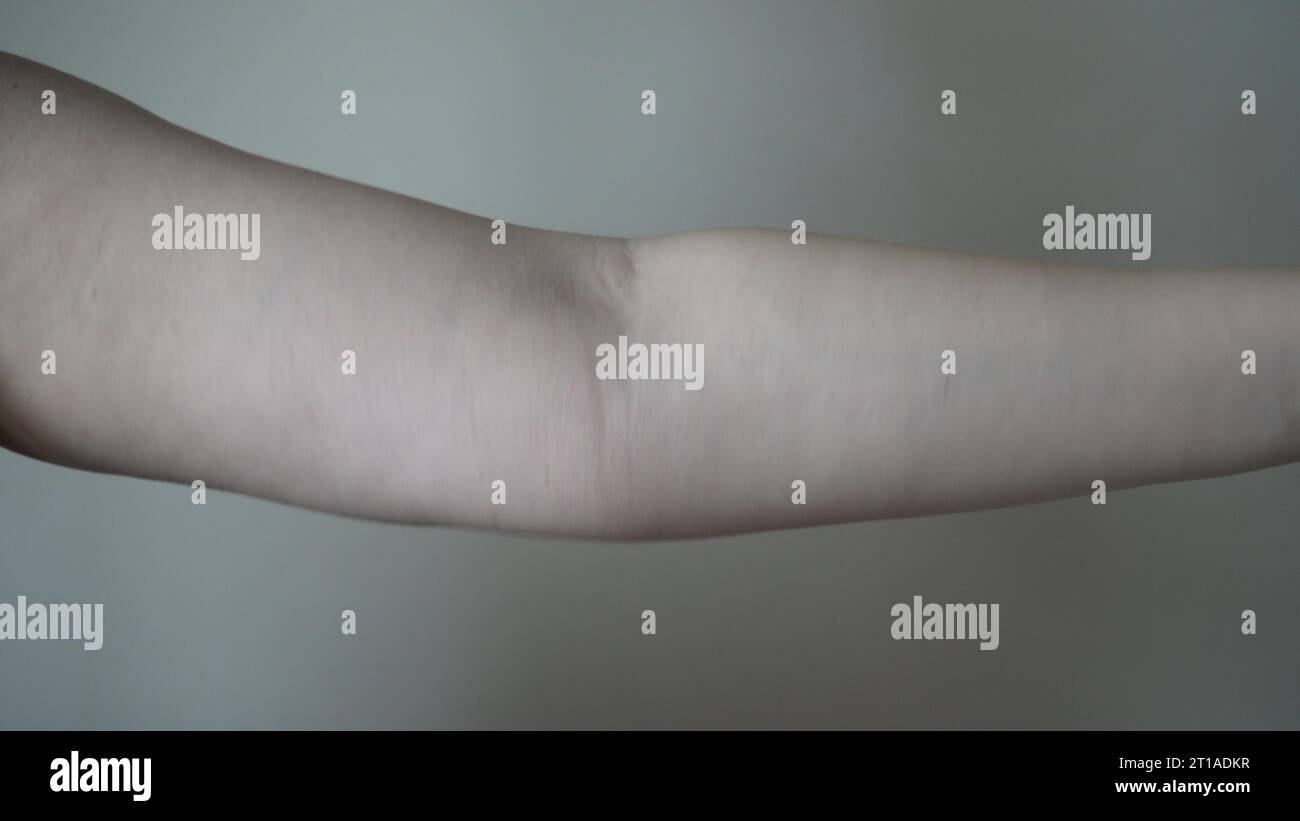 Light-skinned young woman with drooping arms. Sad bad body shape girl ...