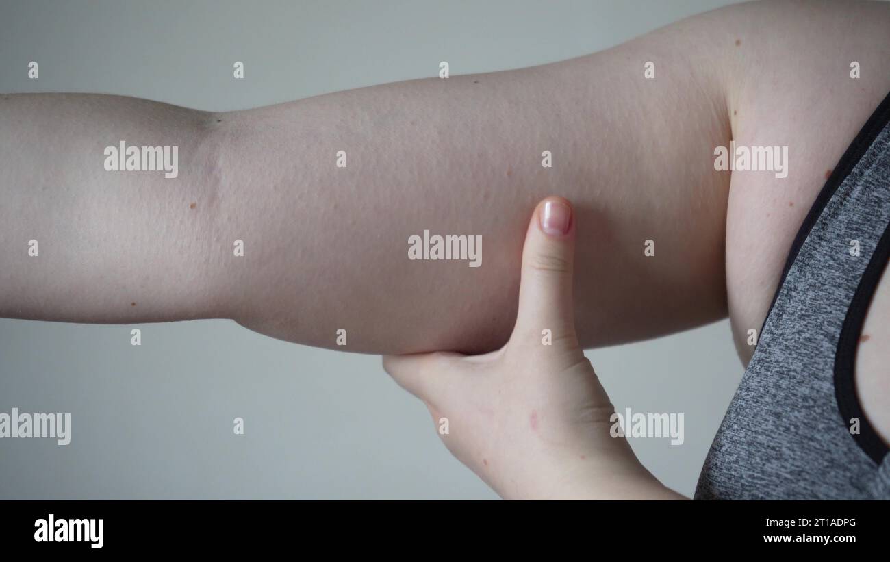 Light-skinned young woman with drooping arms. Sad bad body shape girl ...