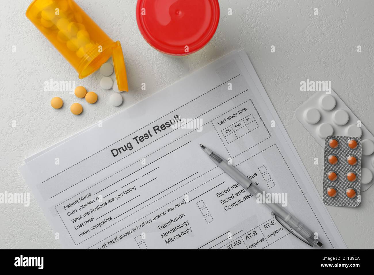 Drug test result form, container with urine sample and pills on light ...