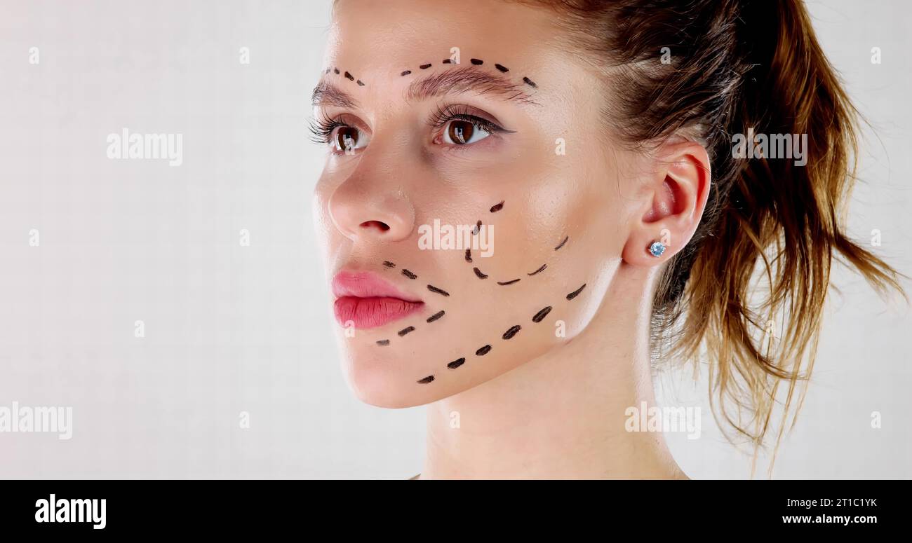 Facial Aesthetics Facelift. Plastic Surgery Drawings On Face Stock ...