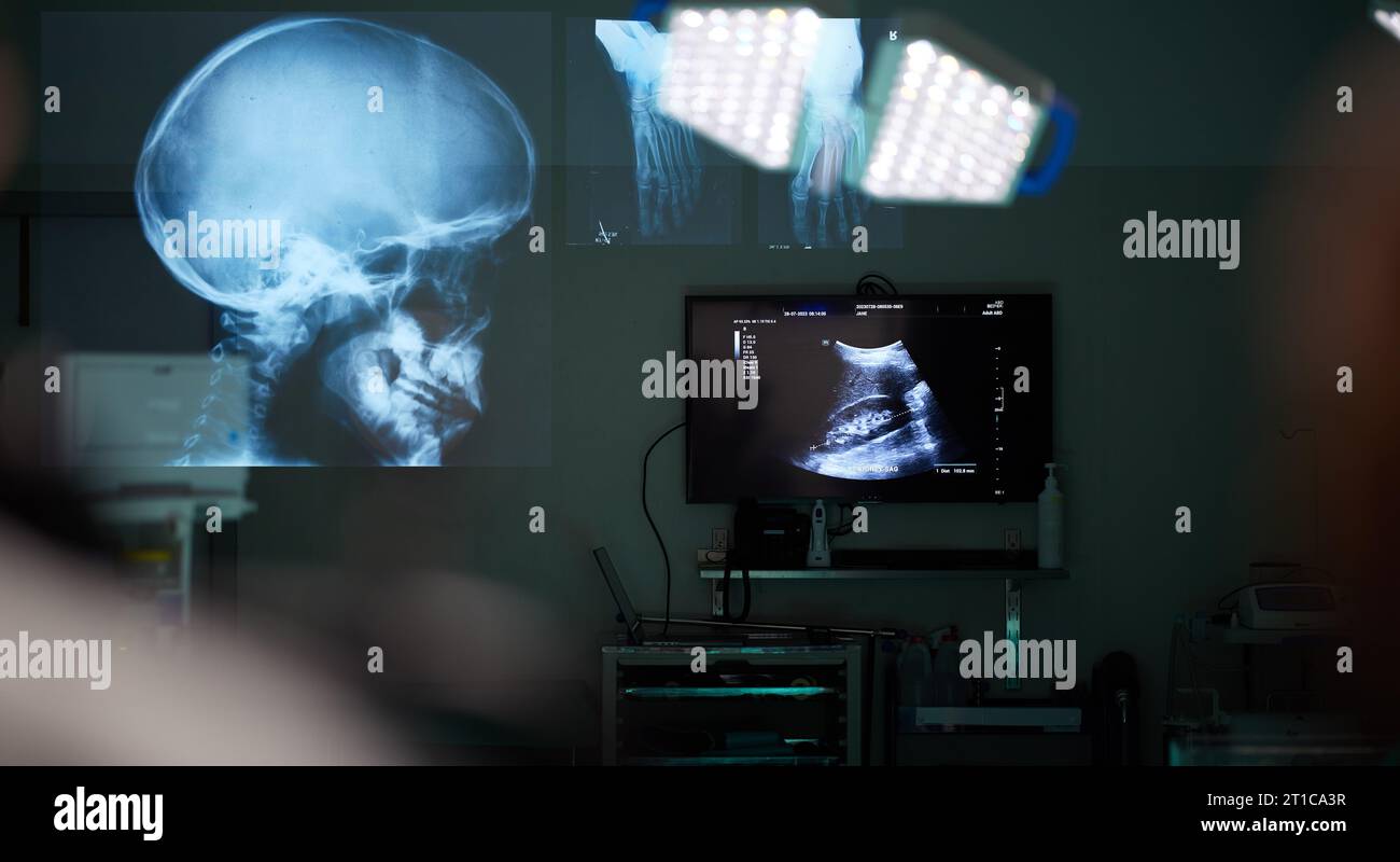 Surgery room, xray and skull with healthcare, neuroscience and medicare ...