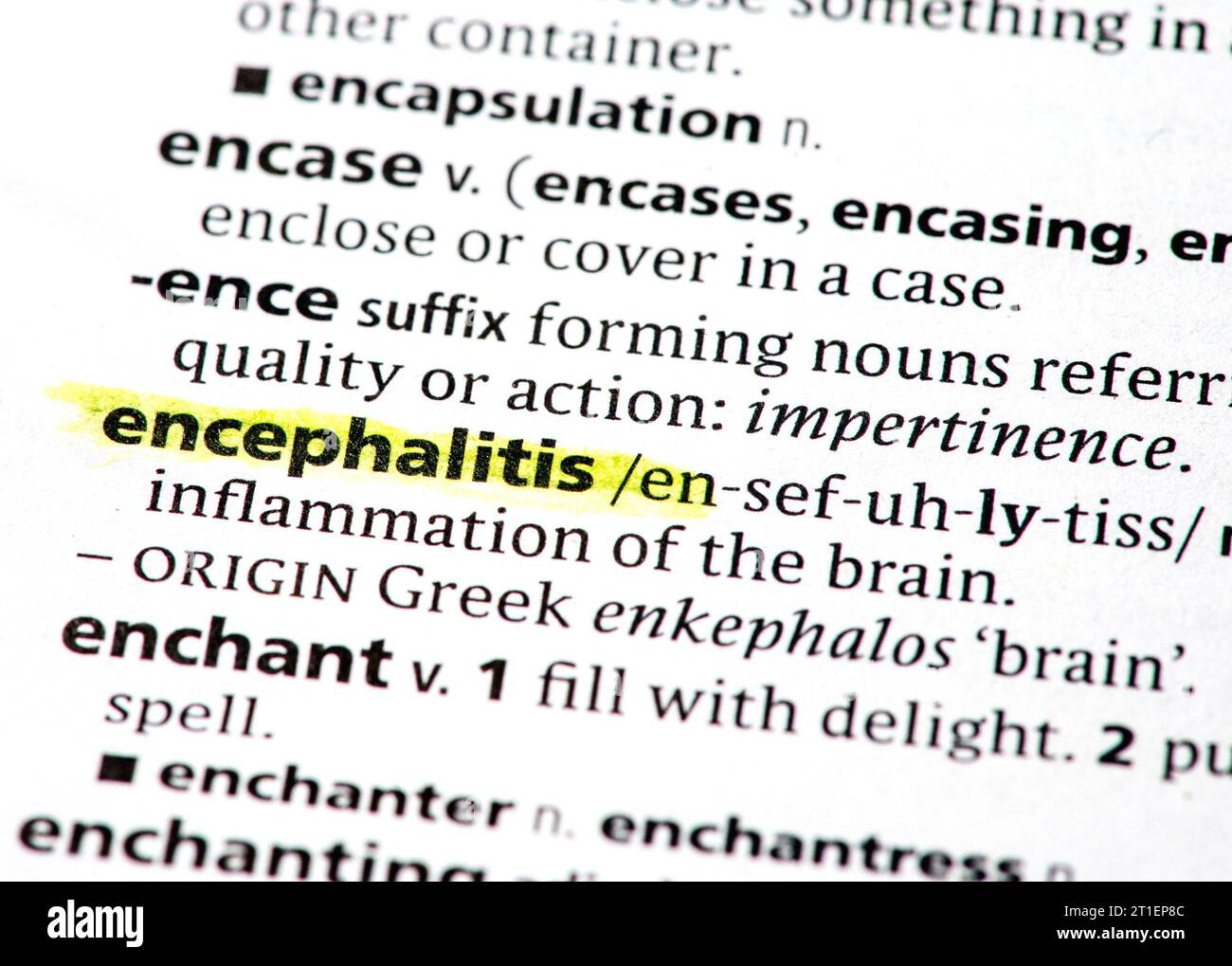 Encephalitis brain hi-res stock photography and images - Alamy