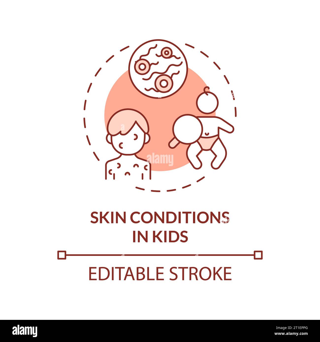 Skin conditions children hi-res stock photography and images - Alamy