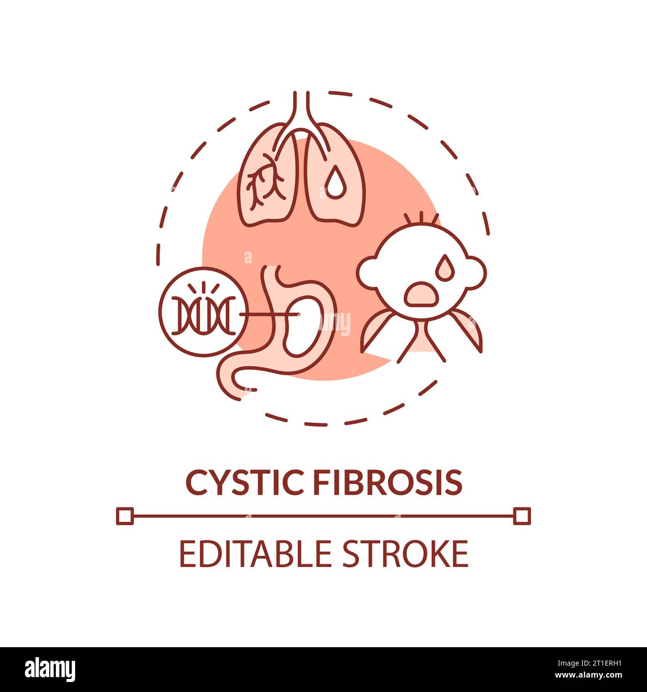 Cystic Fibrosis Lung Cut Out Stock Images And Pictures Alamy