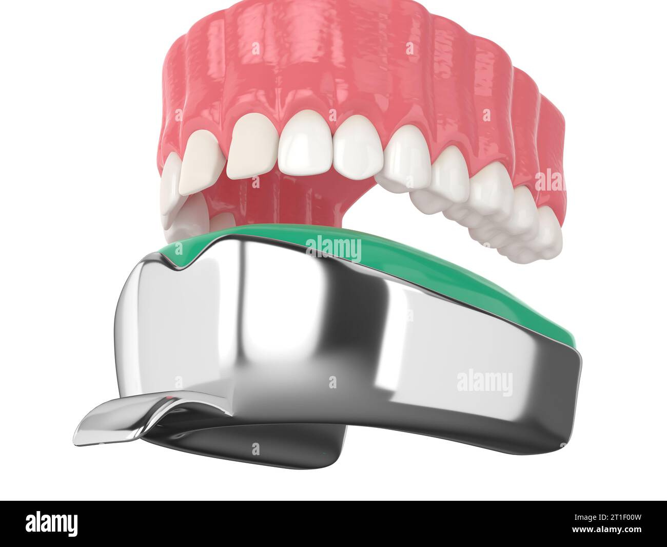3d render of upper jaw with dental impression tray over white ...