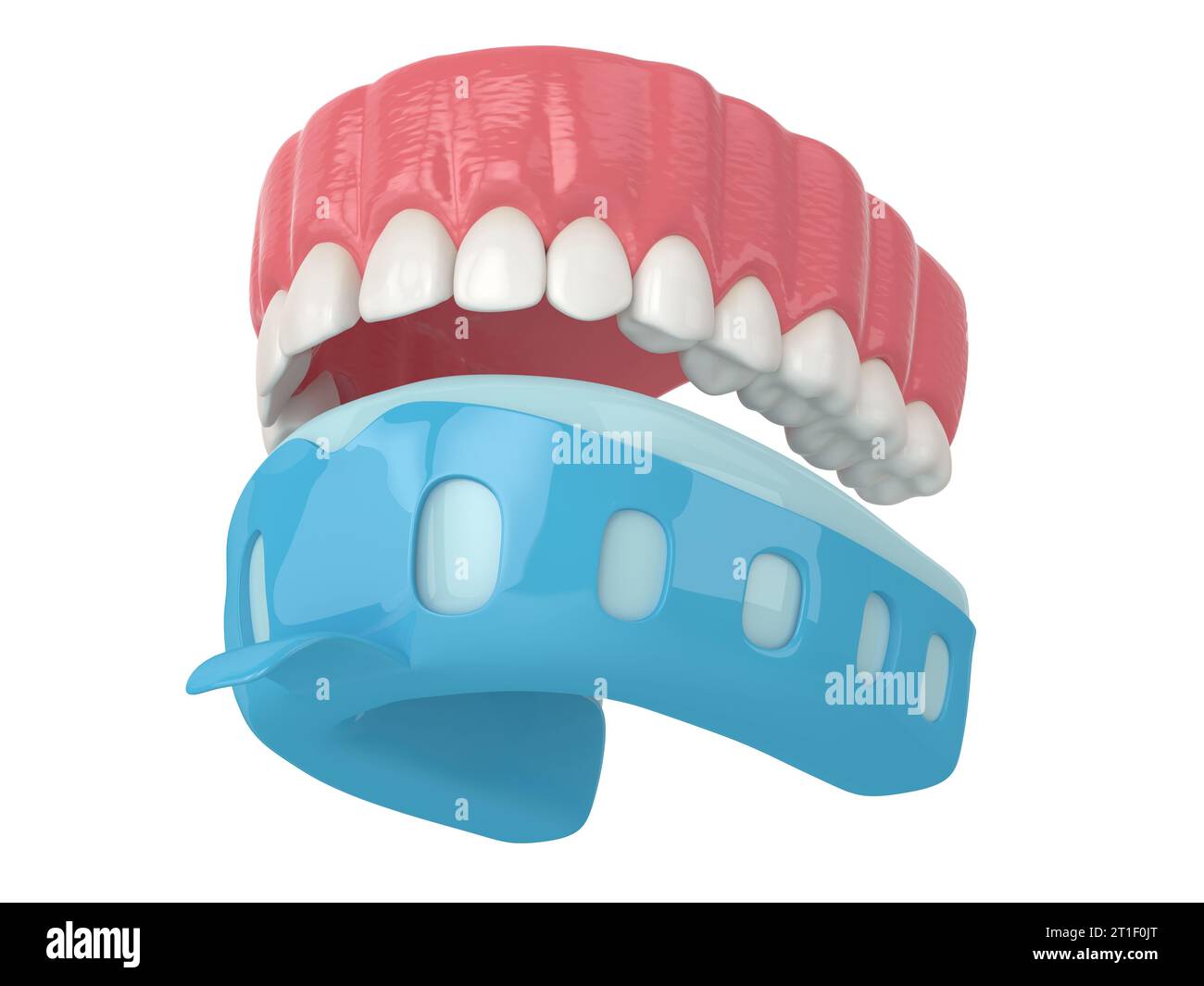3d render of upper jaw with dental impression tray over white ...