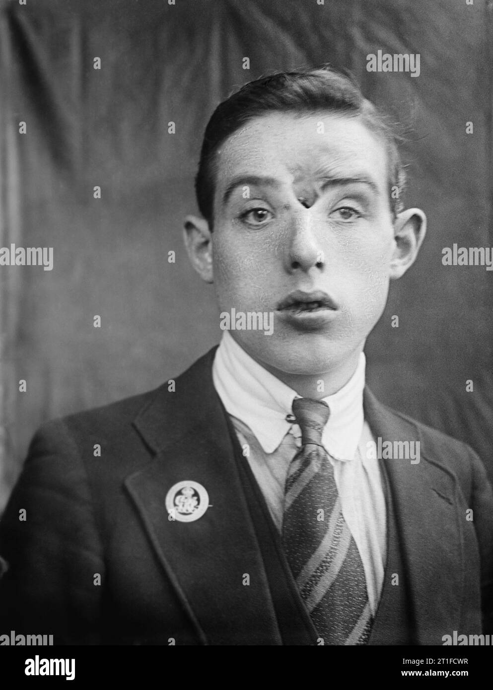 Development of plastic surgery hi-res stock photography and images - Alamy