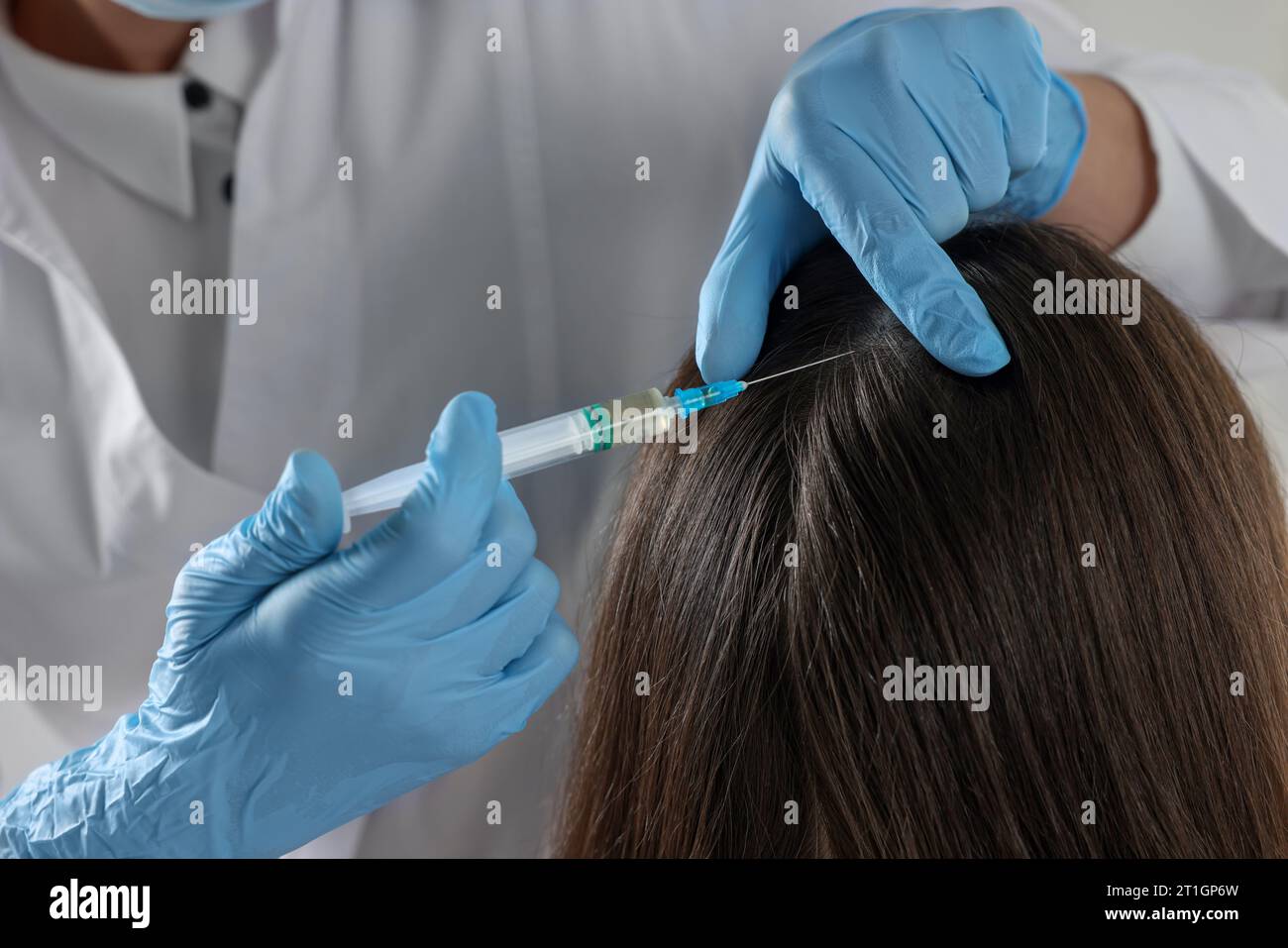 Trichologist giving injection to patient, closeup view Stock Photo - Alamy
