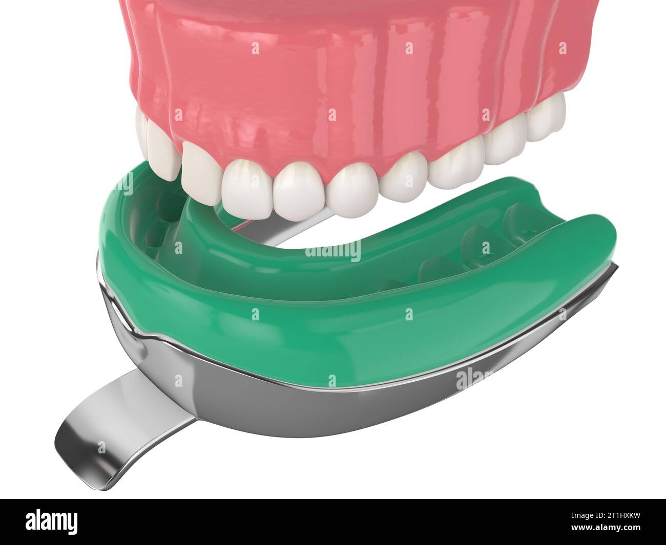 3d render of upper jaw with dental impression tray over white ...