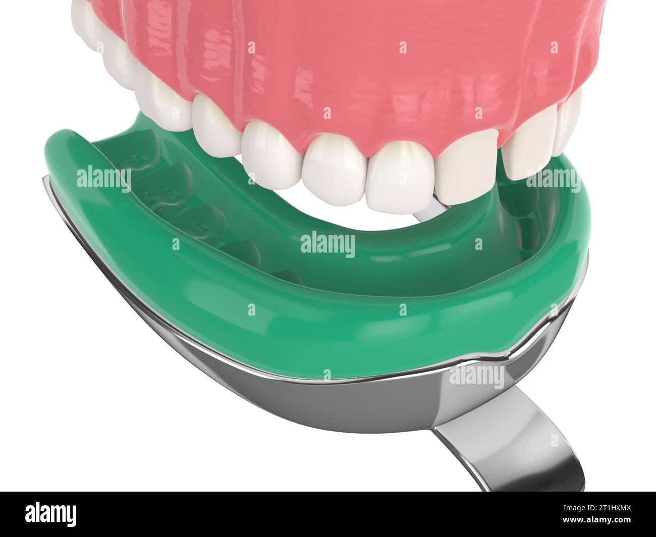 3d render of upper jaw with dental impression tray over white ...