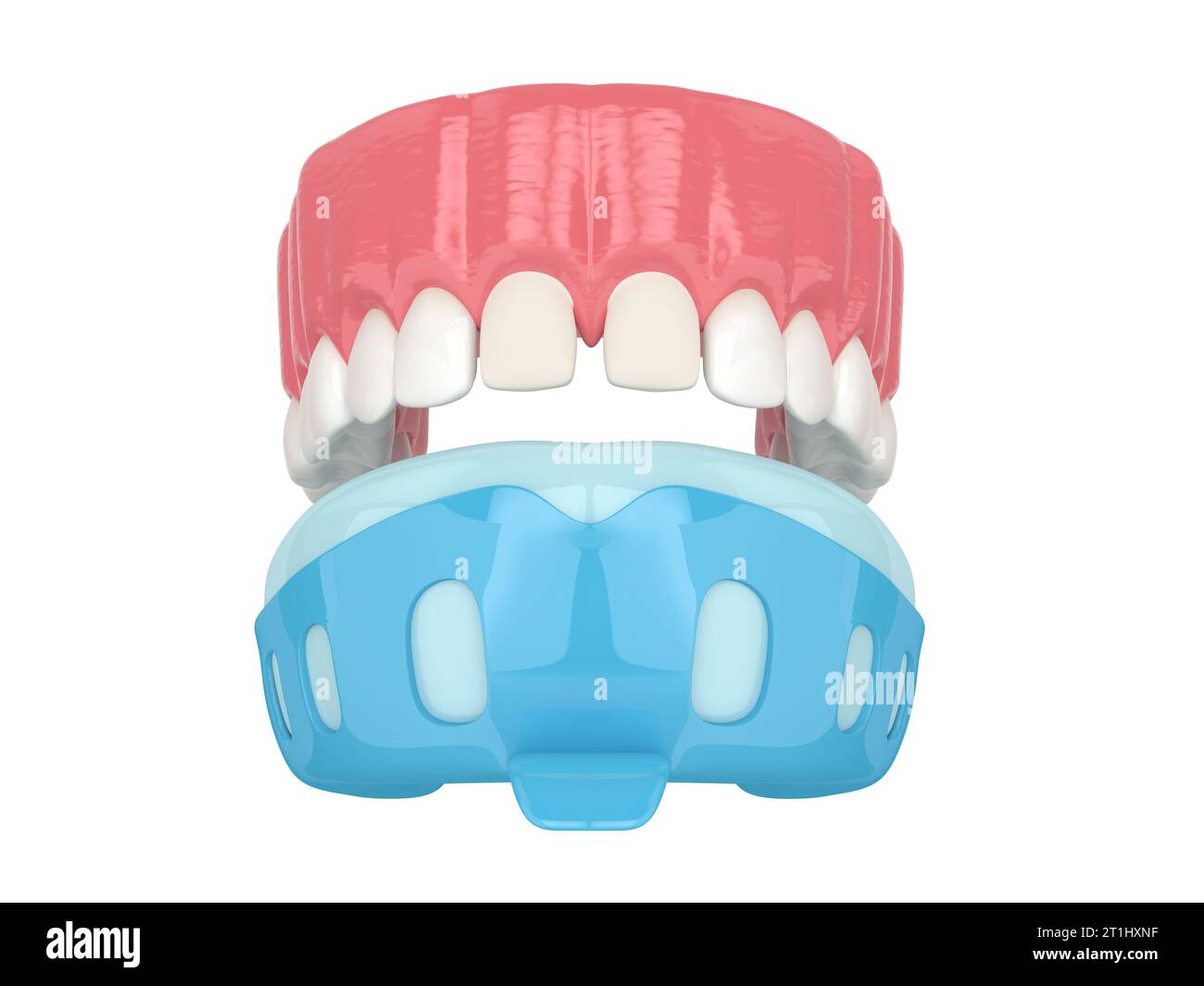 3d render of upper jaw with dental impression tray over white ...
