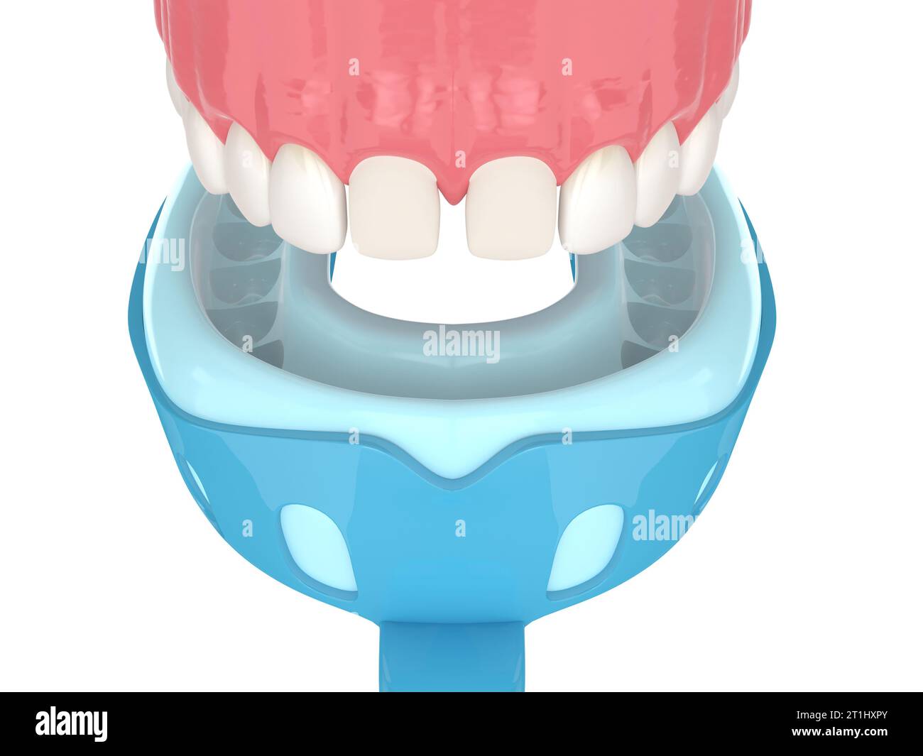 3d render mandibular arch hi-res stock photography and images - Alamy