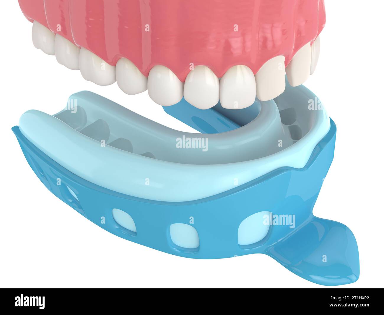 3d render of upper jaw with dental impression tray over white ...
