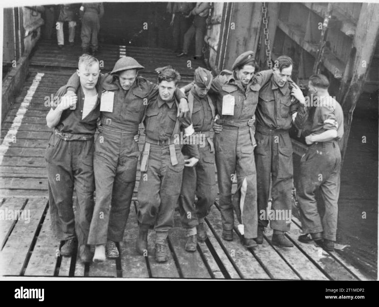 The British Army in the United Kingdom 1939-45 Wounded British troops ...