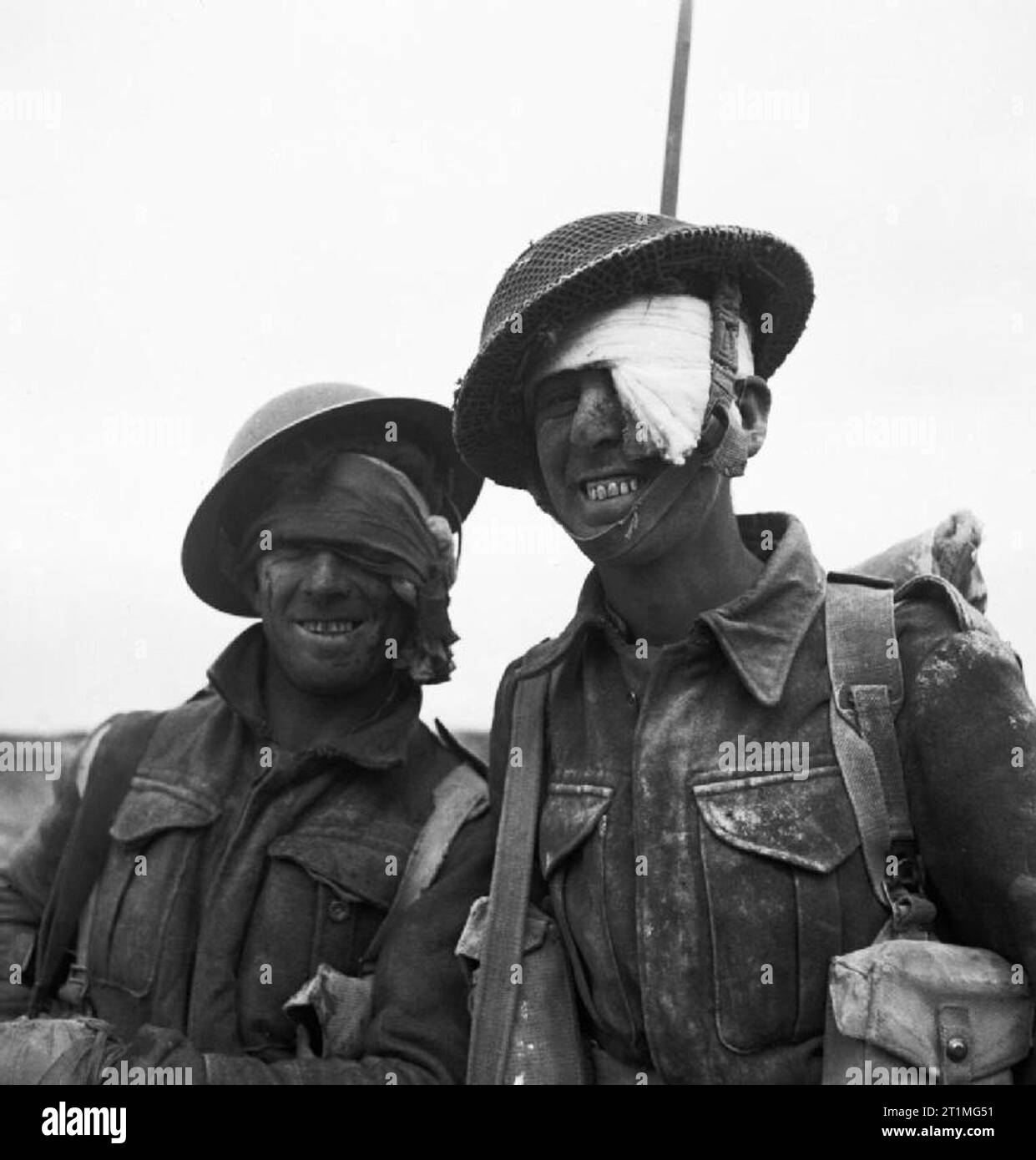Two wounded soldiers from the Durham Light Infantry during the Mareth ...