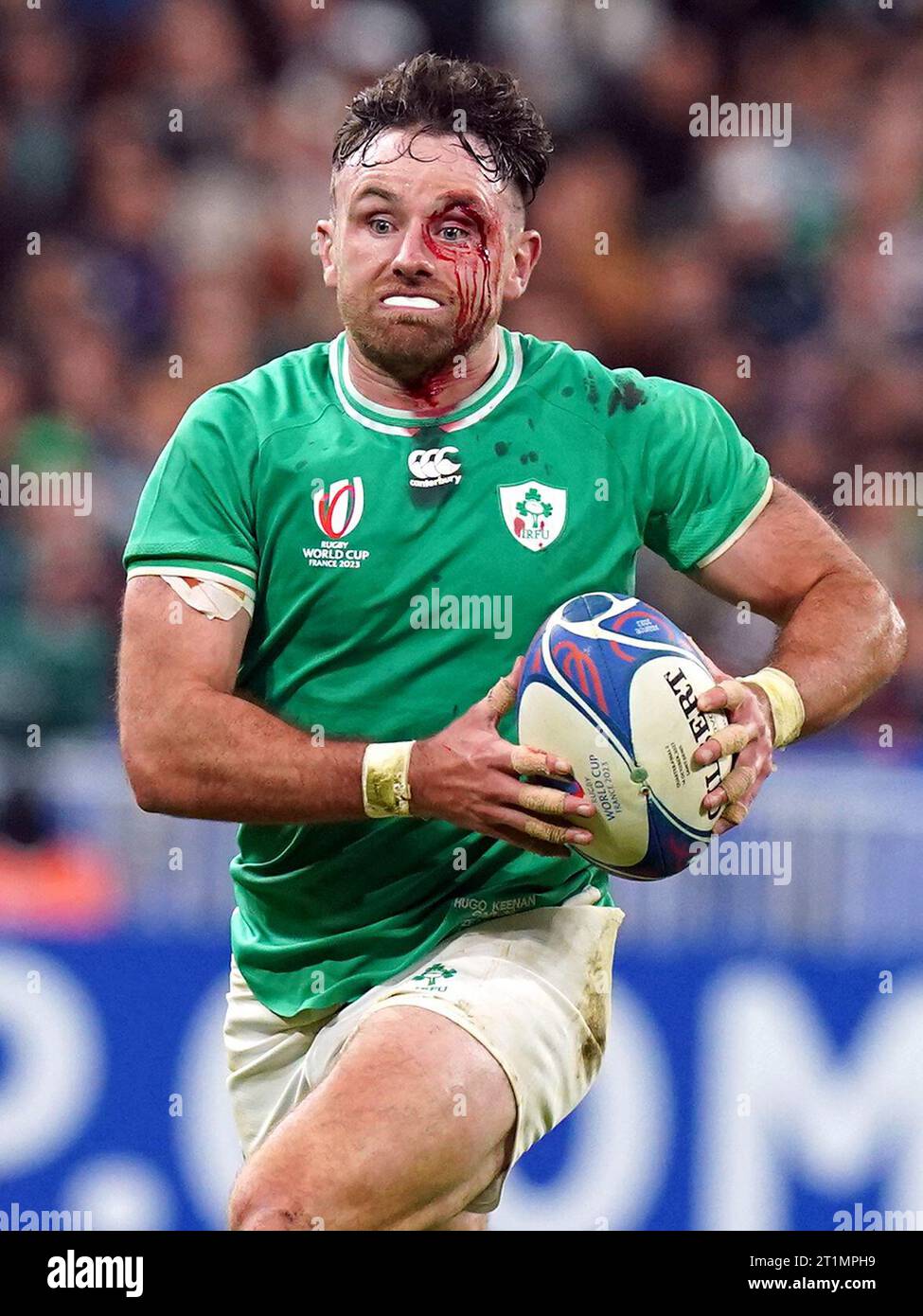 ***EDITOR NOTE: Blood*** Ireland's Huge Keenan in action with blood ...