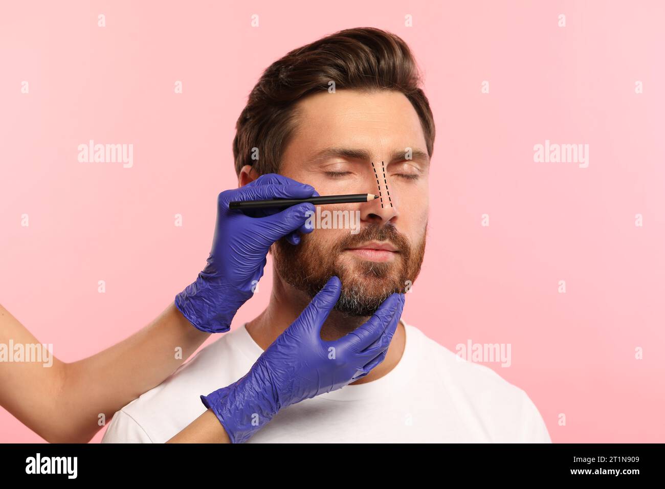 Man preparing for cosmetic surgery, pink background. Doctor drawing ...