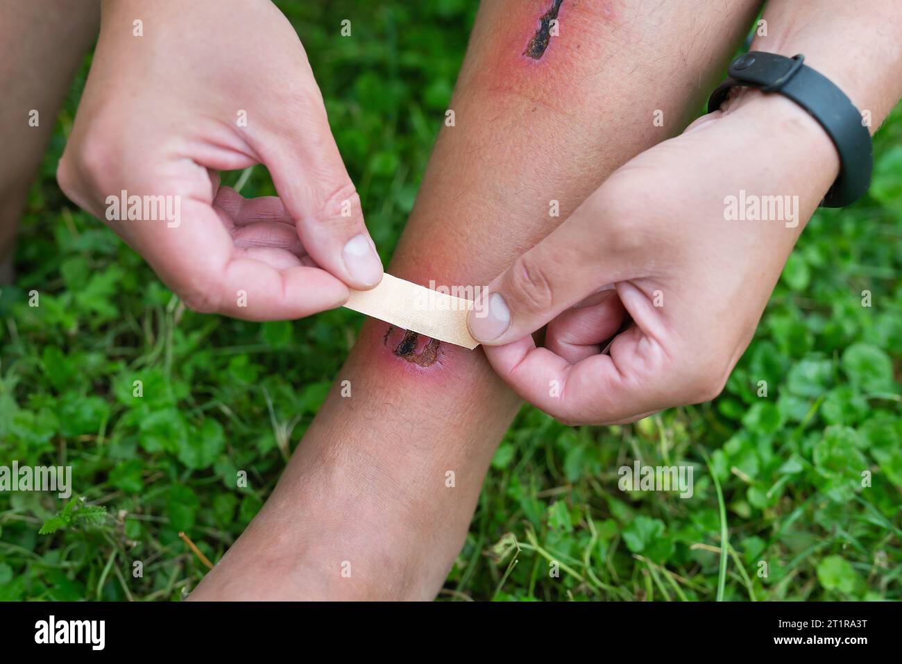 The hand of a young man applies a plaster to a fresh wound. Bad fall ...