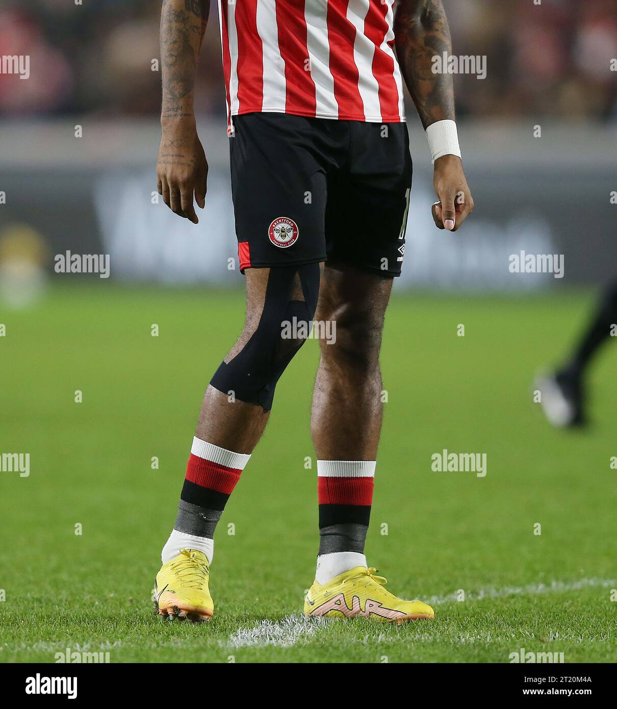 Ivan Toney of Brentford with his leg injury heavily strapped ...