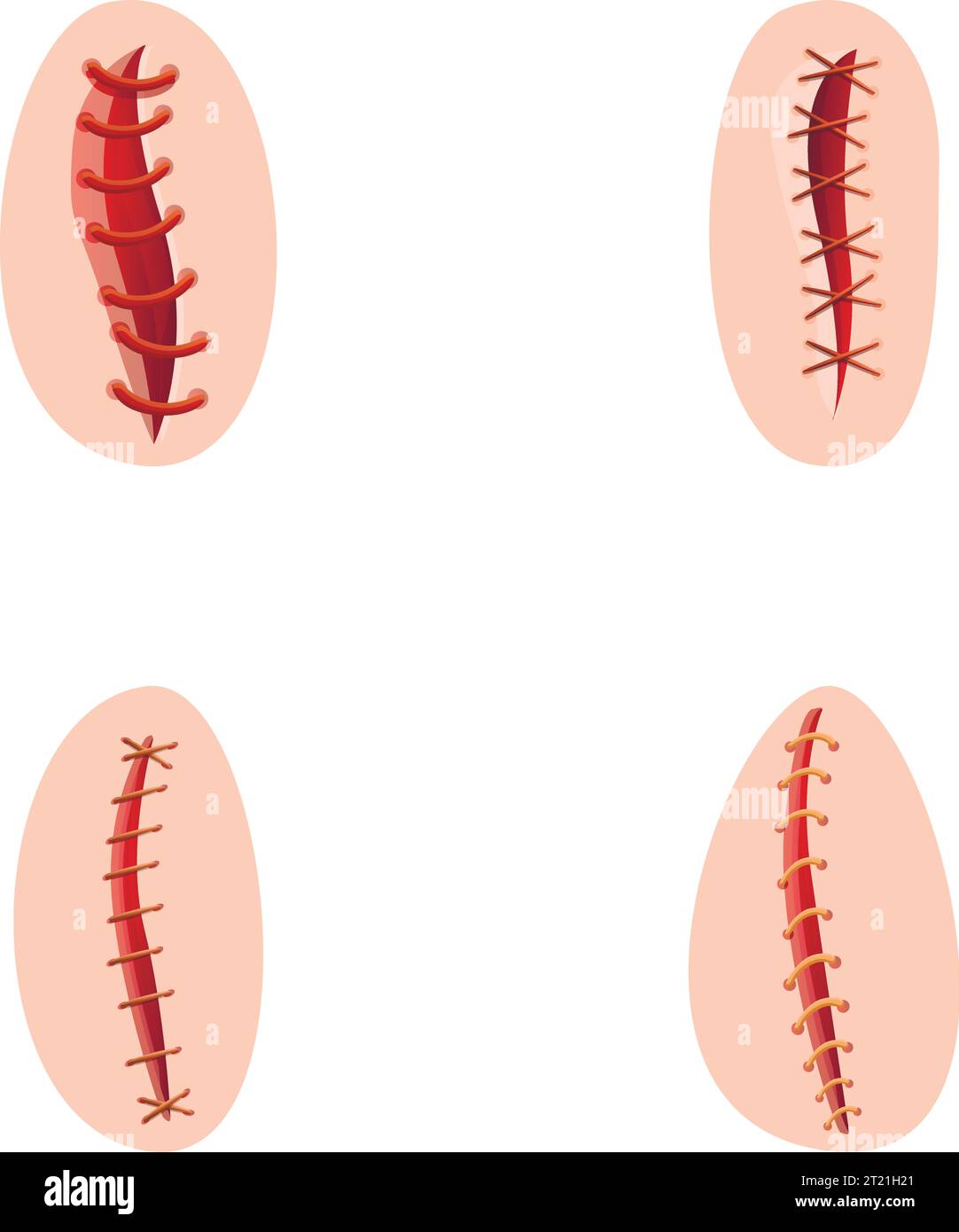 Surgical suture icons set cartoon vector. Various type of operating suture. Surgery, healthcare ...