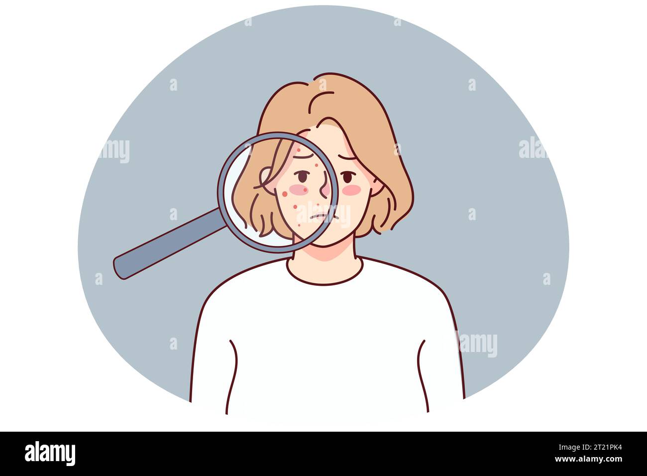 Unhappy woman with acne on face under magnifying glass. Upset young ...
