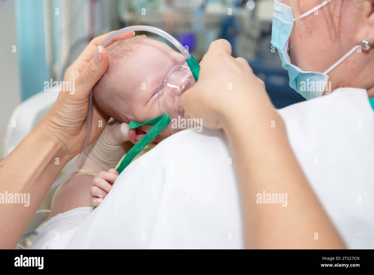 Baby with an oxygen mask in the neonatal unit.Baby wear oxygen mask ...