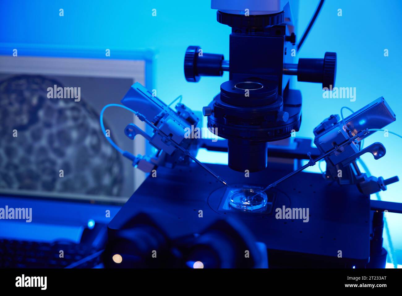 Lab setup being used during intracytoplasmic sperm injection procedure ...