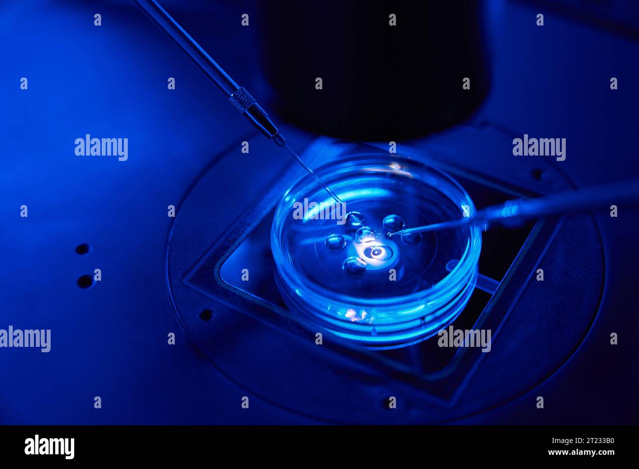 Closeup of intracytoplasmic sperm injection being performed in Petri ...