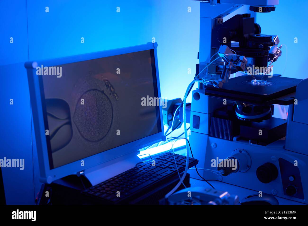 Icsi procedure hi-res stock photography and images - Alamy