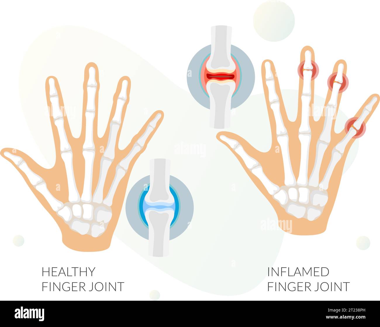 Human maxilla bone Stock Vector Images - Alamy
