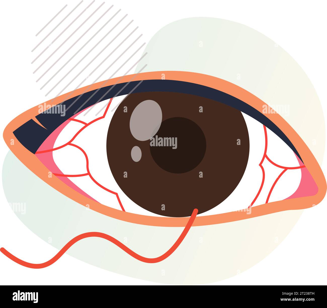 Fungal infection vector vectors hi-res stock photography and images - Alamy