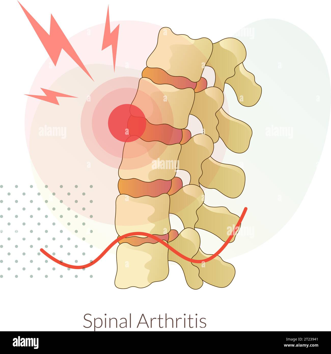 Spinal injury Stock Vector Images - Alamy