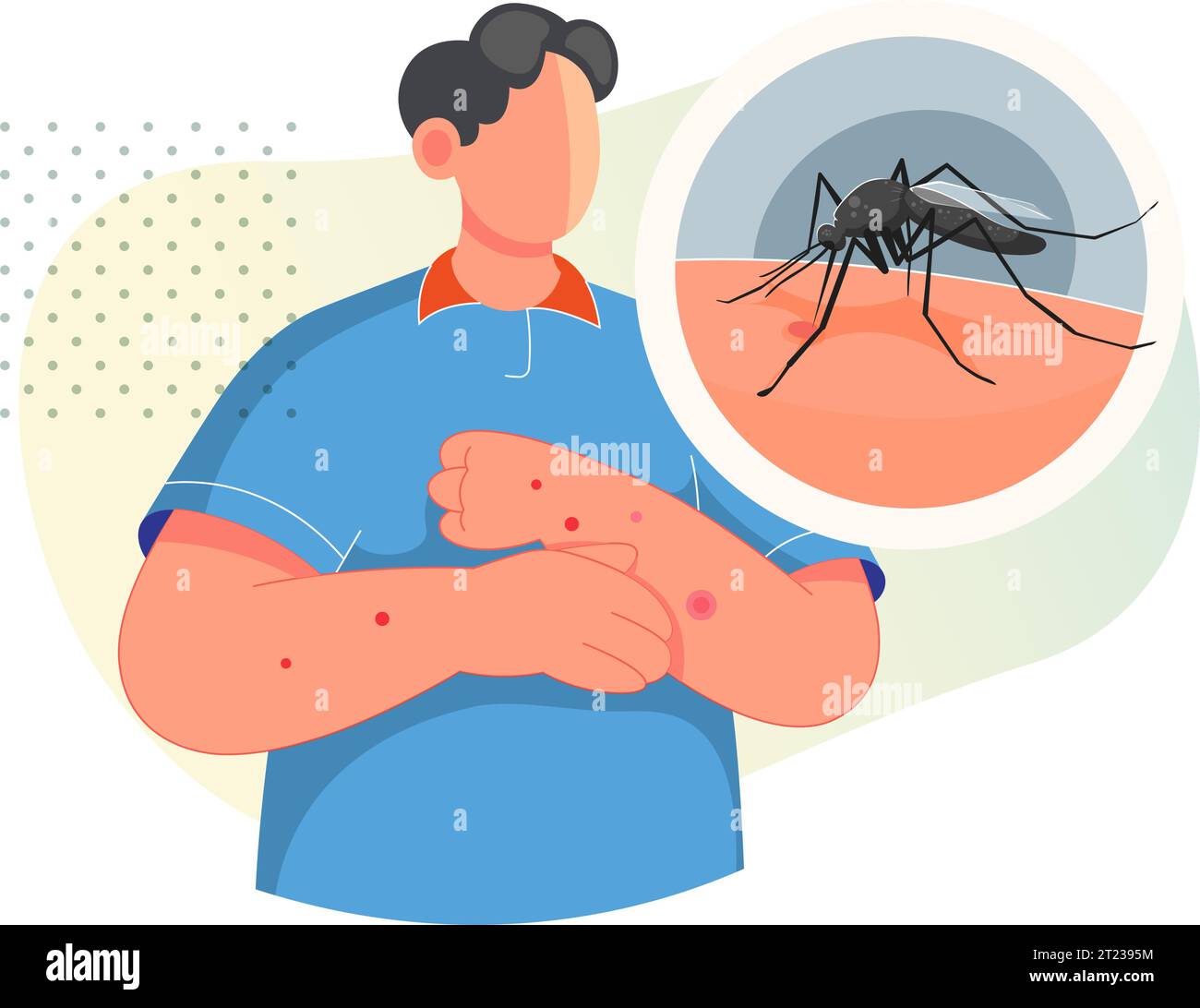 Mosquito biting on Human Skin - Stock Illustration as EPS 10 File Stock ...