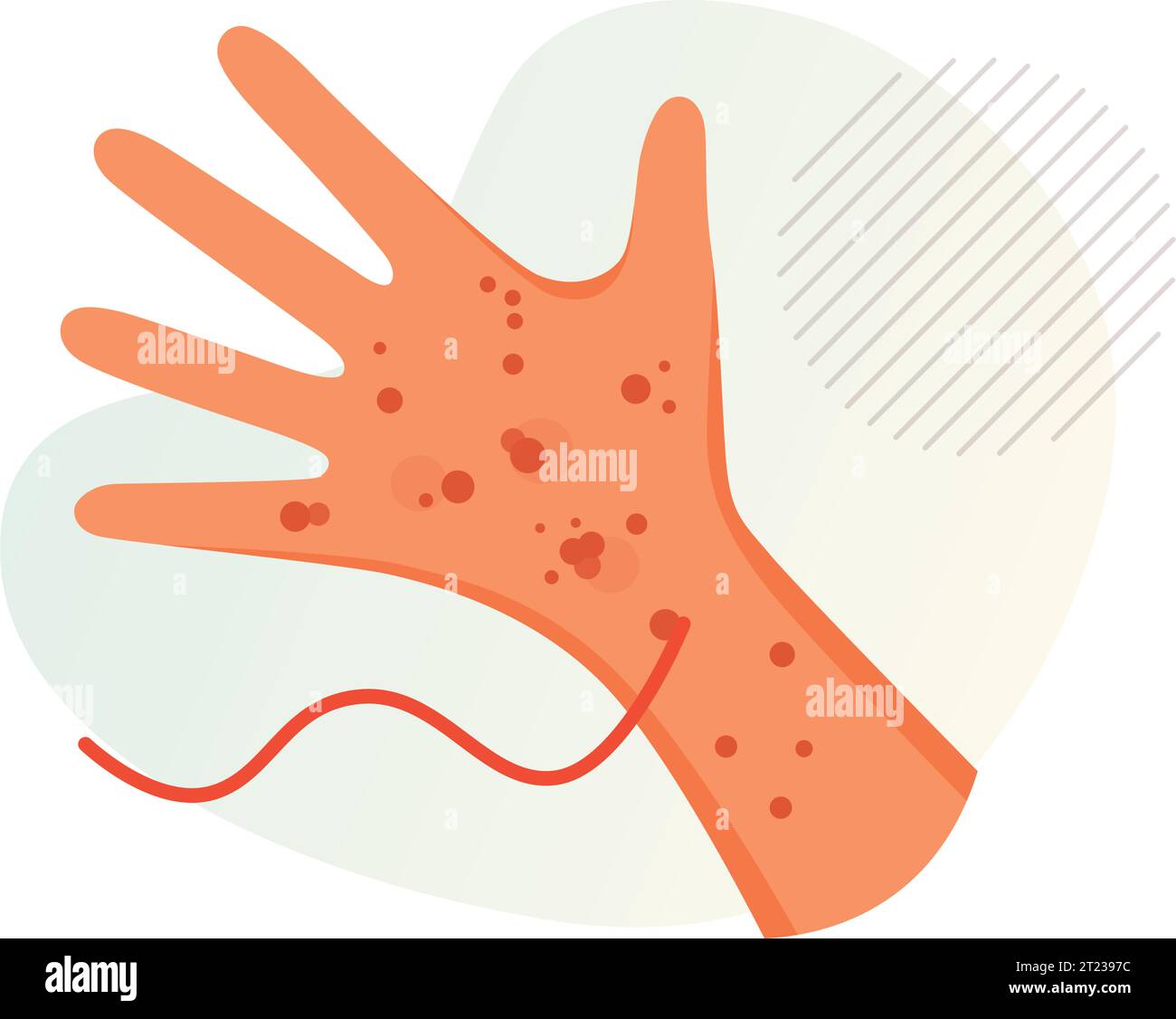 Skin Rashes and Spots as Symptoms - Icon as EPS 10 File Stock Vector ...