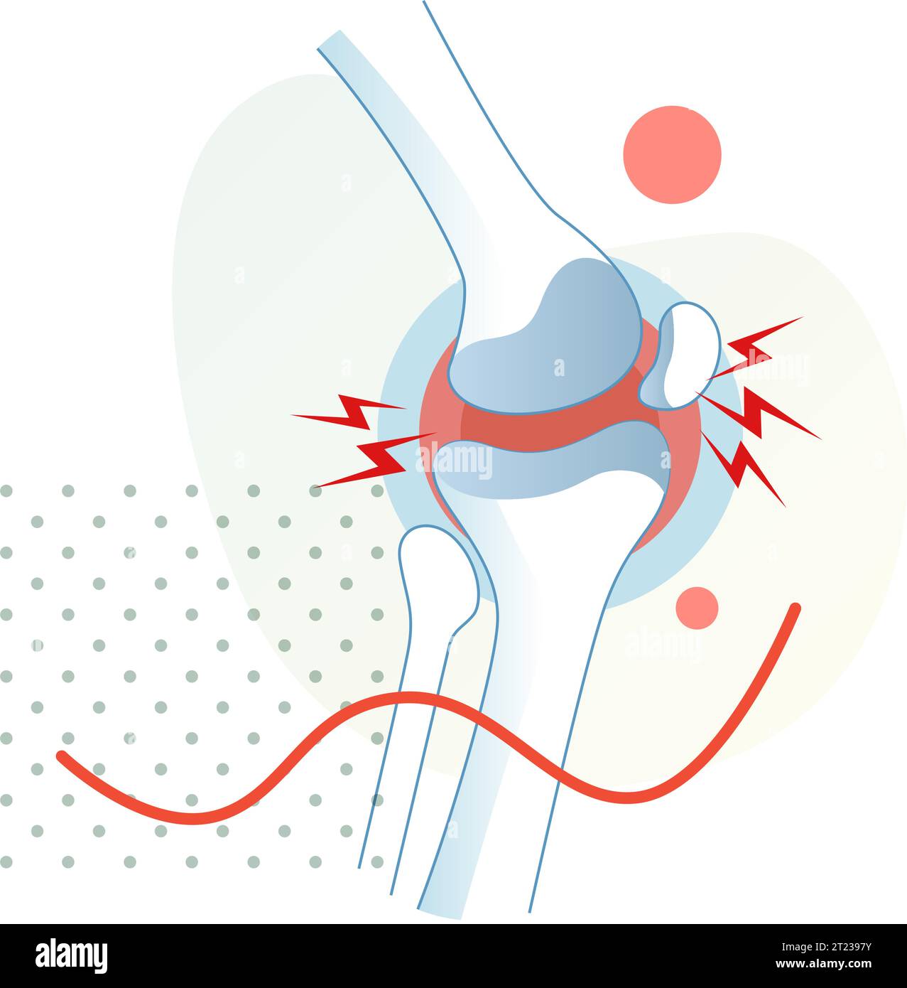 Knee Joint - Pain - Stock Illustration as EPS 10 File Stock Vector ...