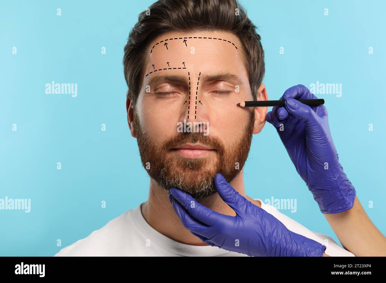Man preparing for cosmetic surgery, light blue background. Doctor ...