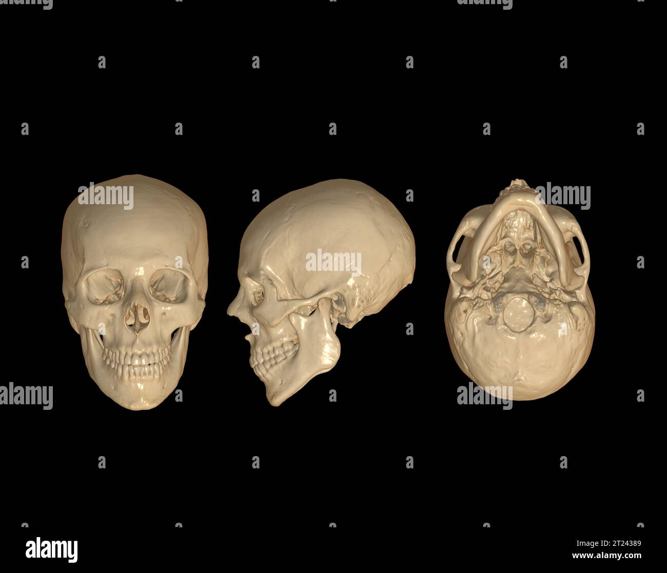 3d reconstruction of the skull hi-res stock photography and images - Alamy
