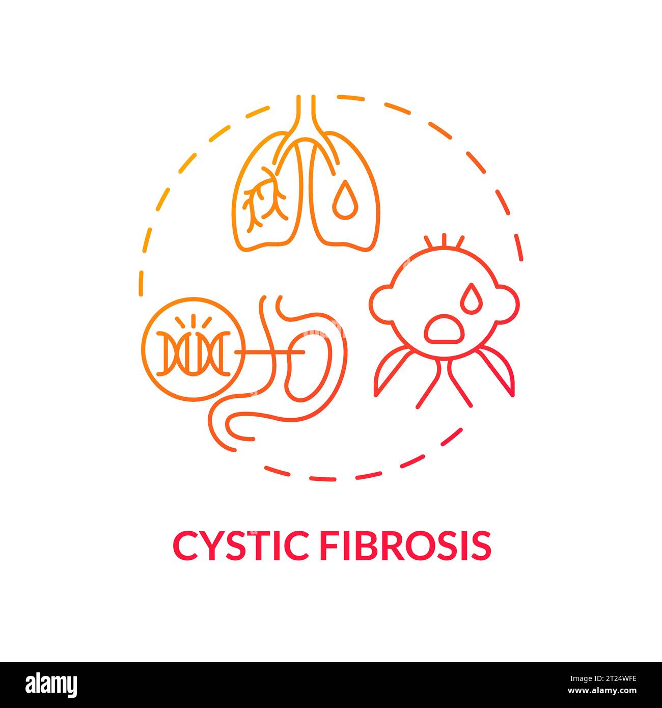 2D thin line gradient icon cystic fibrosis concept Stock Vector Image ...