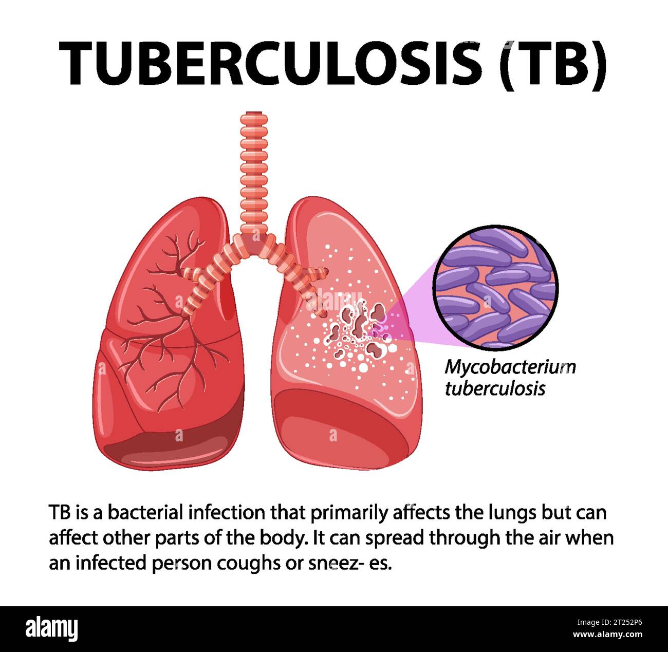 Illustrated infographic showcasing the medical education of human lung ...