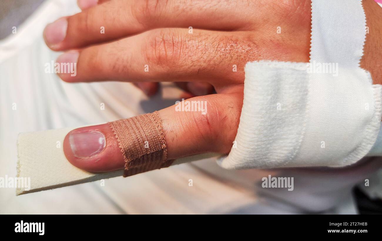 Finger ligaments hi-res stock photography and images - Alamy