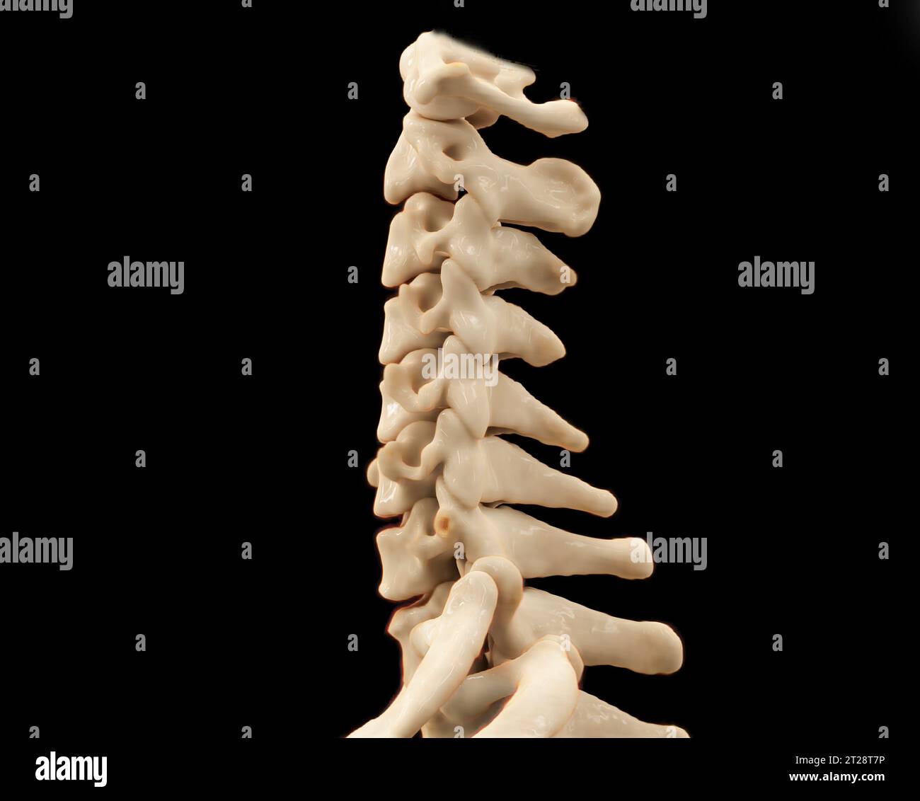 CT scan of C-Spine or Cervical spine 3D rendering for diagnosis ...
