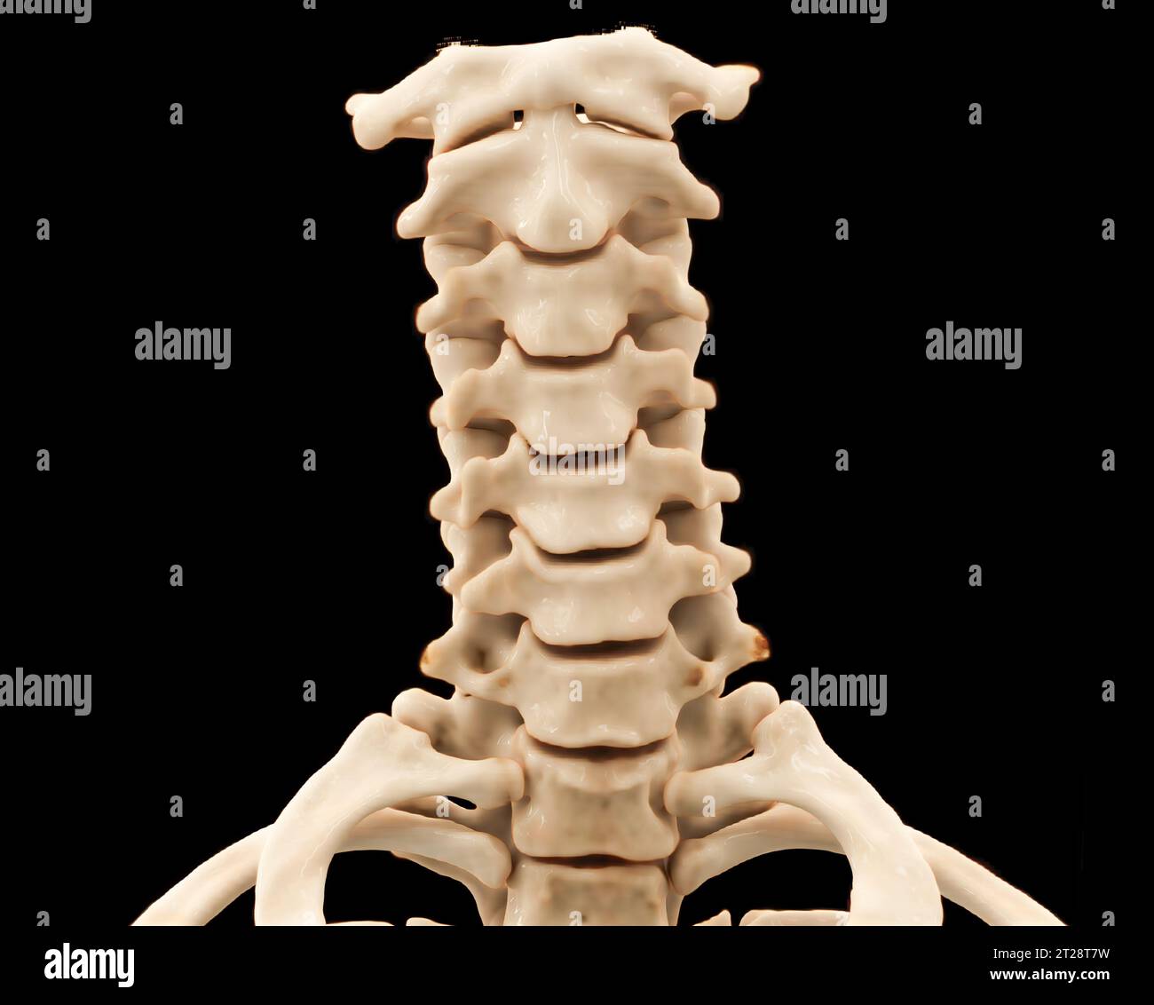 CT scan of C-Spine or Cervical spine 3D rendering for diagnosis ...