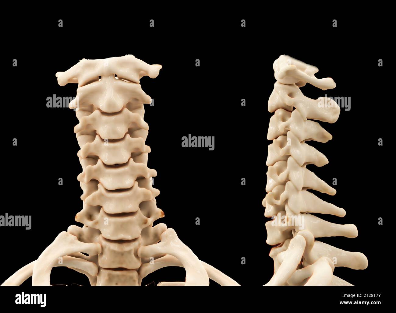CT scan of C-Spine or Cervical spine 3D rendering for diagnosis ...