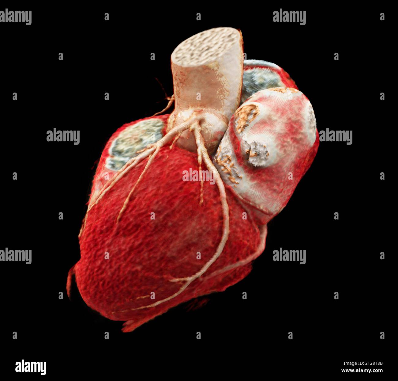Human heart 3d ct scan image hi-res stock photography and images - Alamy