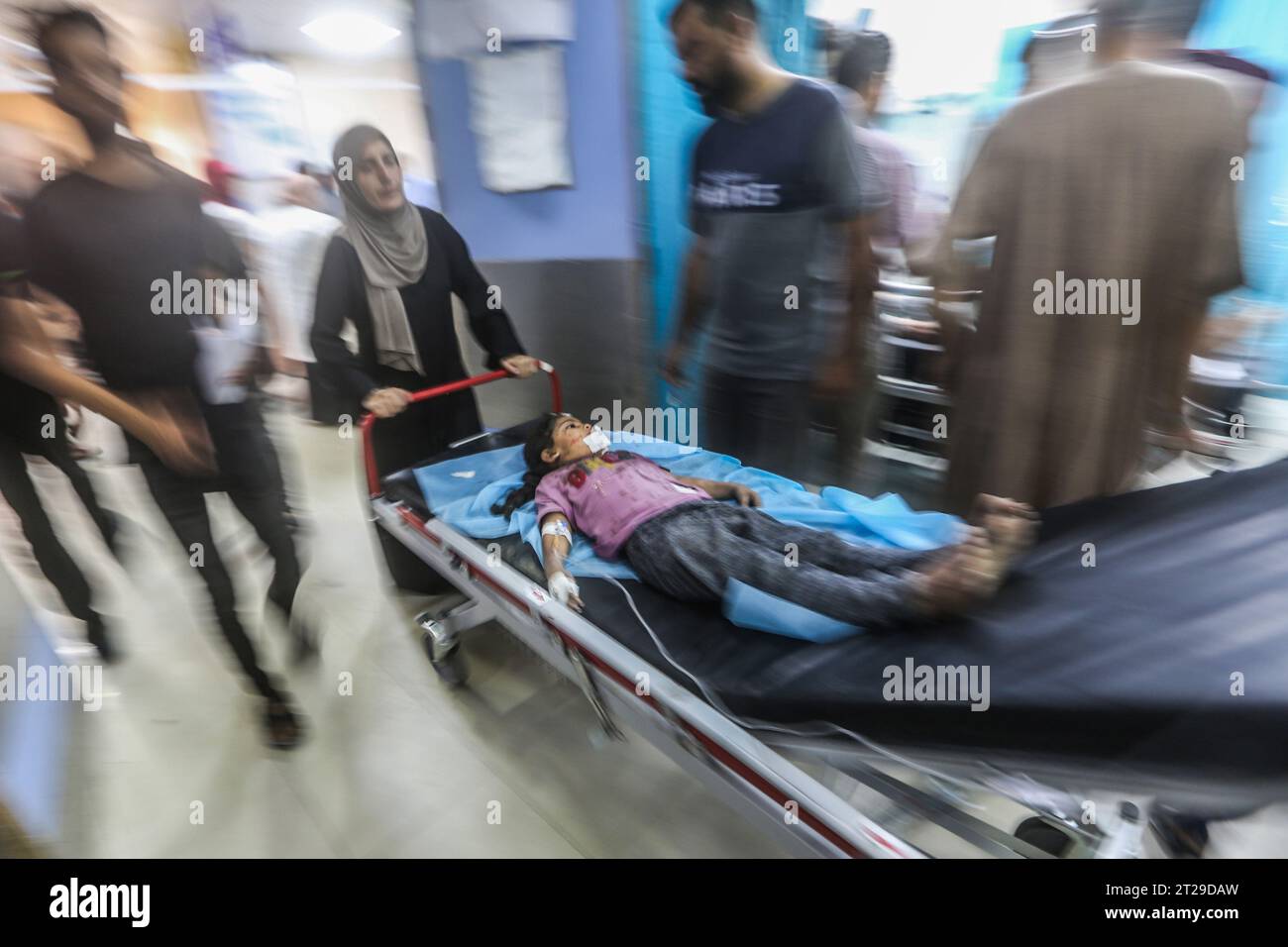 Khan Yunis, Palestinian Territories. 18th Oct, 2023. An injured child ...