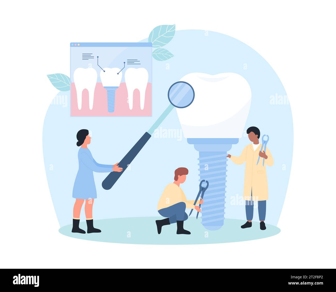 Dental implant, dentistry vector illustration. Cartoon tiny dentists ...