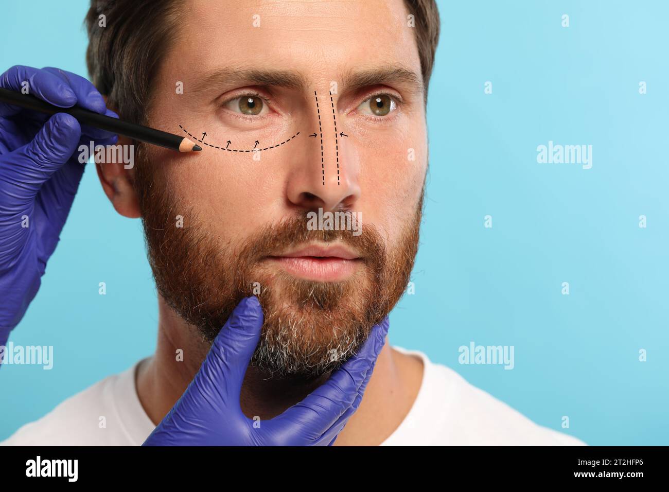 Man preparing for cosmetic surgery, light blue background. Doctor ...